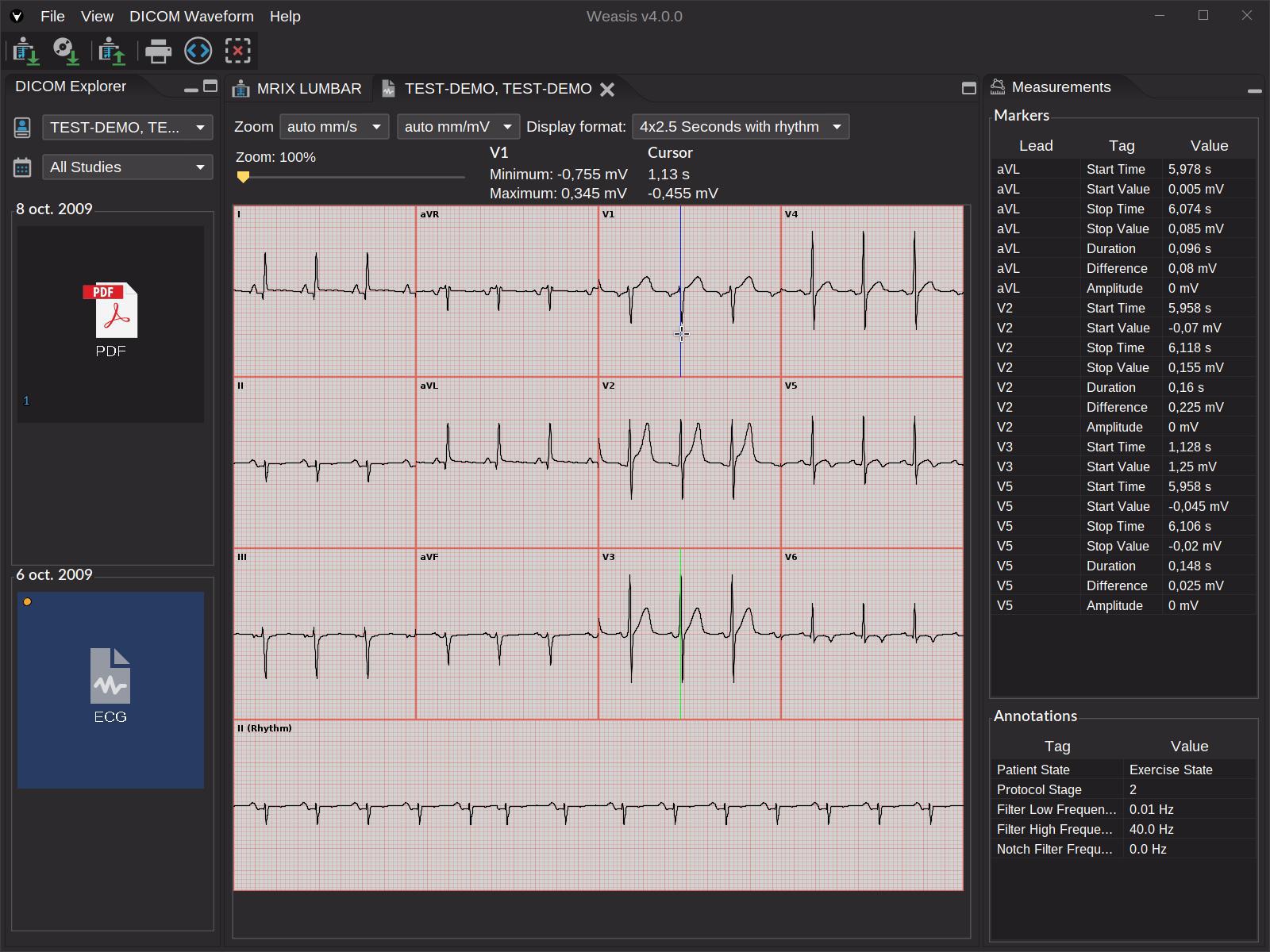 Weasis: Free DICOM viewer :: Weasis Documentation